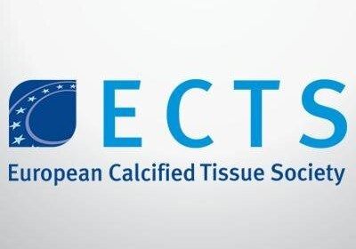 Τι είναι οι Διδακτικές Μονάδες (ECTS)